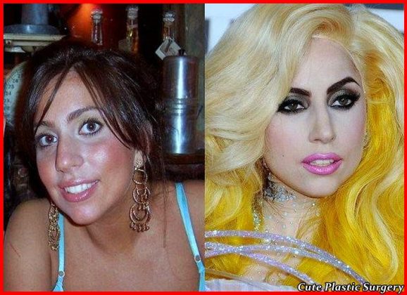 Lady Gaga Plastic Surgery Rumors - Celebrities Plastic Surgery