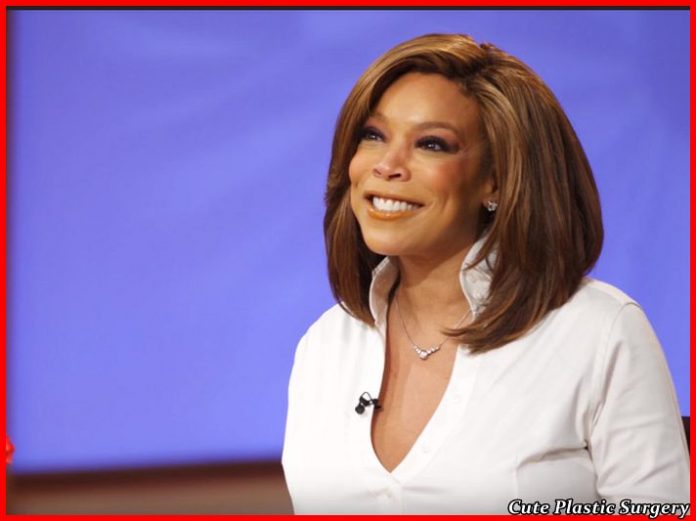 Wendy Williams Plastic Surgery - Celebrities Plastic Surgery