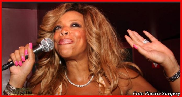 Wendy Williams Plastic Surgery - Celebrities Plastic Surgery