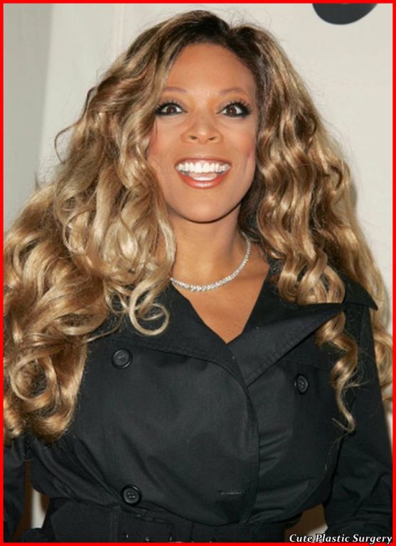 Wendy Williams Plastic Surgery - Celebrities Plastic Surgery