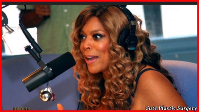 Wendy Williams Plastic Surgery - Celebrities Plastic Surgery