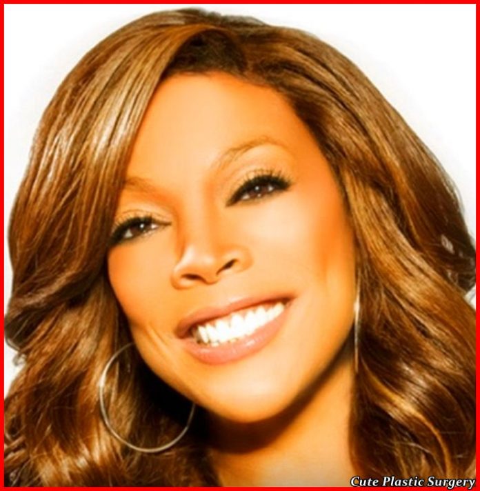 Wendy Williams Plastic Surgery - Celebrities Plastic Surgery