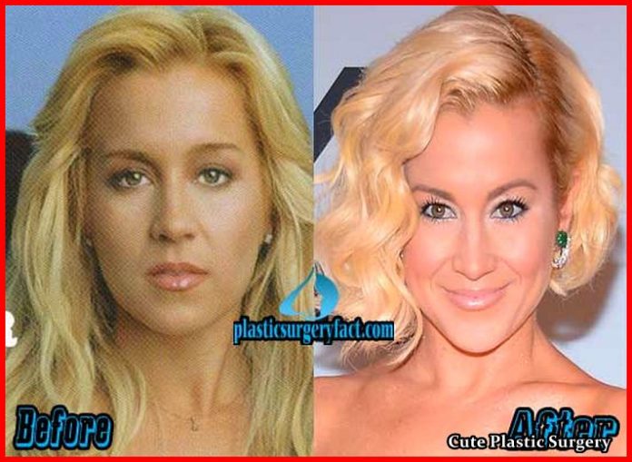 Kellie Pickler Plastic Surgery Celebrities Plastic Surgery