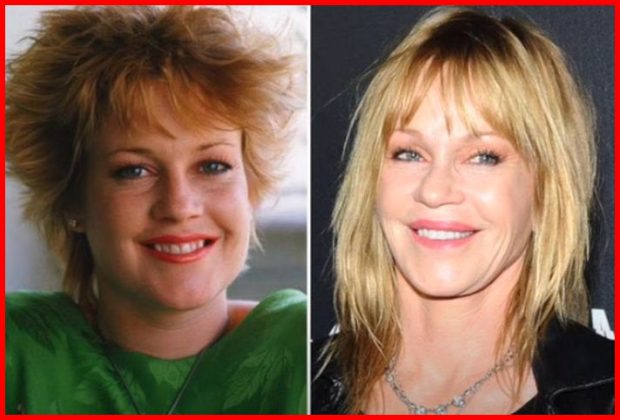 Melanie Griffith Plastic Surgery – How well did it go? - Celebrities ...