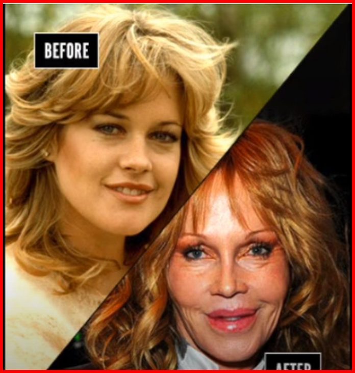 Melanie Griffith Plastic Surgery – How well did it go? - Celebrities ...