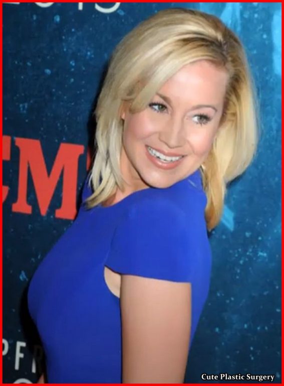 Kellie Pickler Plastic Surgery - Celebrities Plastic Surgery