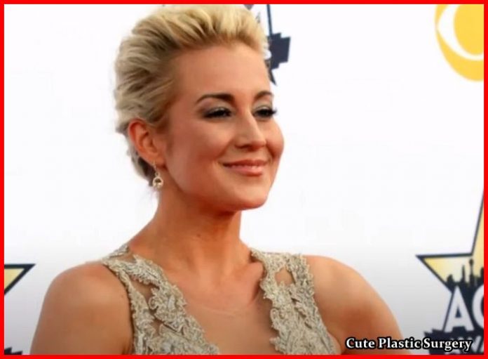 Kellie Pickler Plastic Surgery Celebrities Plastic Surgery