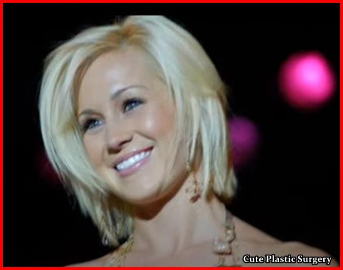 Kellie Pickler Plastic Surgery - Celebrities Plastic Surgery