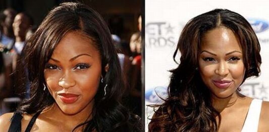 Home - Celebrities Plastic Surgery